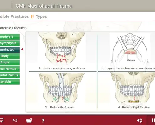 Maxillofacial Trauma Course